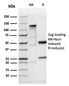 Recombinant IgA (Immunoglobulin Alpha Heavy Chain) (B-Cell Marker ...