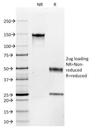CD117 / c-Kit (Marker for Gastrointestinal Stromal Tumors) Antibody ...