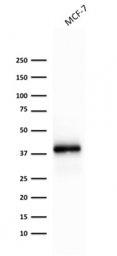 Recombinant Ep-CAM / CD326 (Extracellular Domain) (Epithelial Marker ...