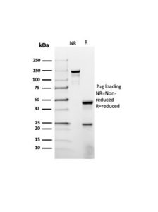 Recombinant Prolactin (Pituitary Tumor Marker) Antibody - Clone rPRL ...