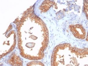 Recombinant Beta-2 Microglobulin (Renal Failure & Tumor Marker ...