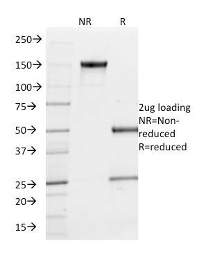 PU.1 (SPI-1) (B-Cell Marker) Antibody - Clone PU1/2146 - Gene ID 6688