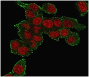 TNF-alpha (Tumor Necrosis Factor alpha) Antibody - Clone TNF706 - Gene ID 7124