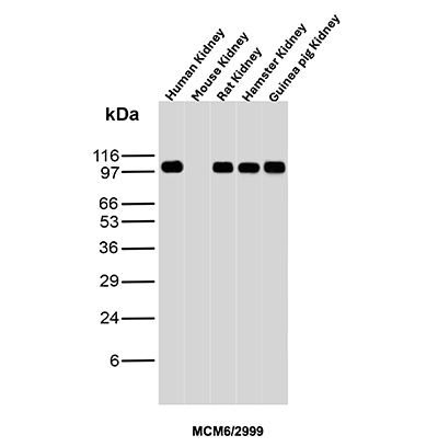 MCM6 (Proliferation Marker) Antibody - Clone MCM6/2999 - Gene ID 4175