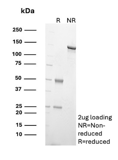 Recombinant CD59 / Complement Regulatory Protein / Protectin Antibody ...