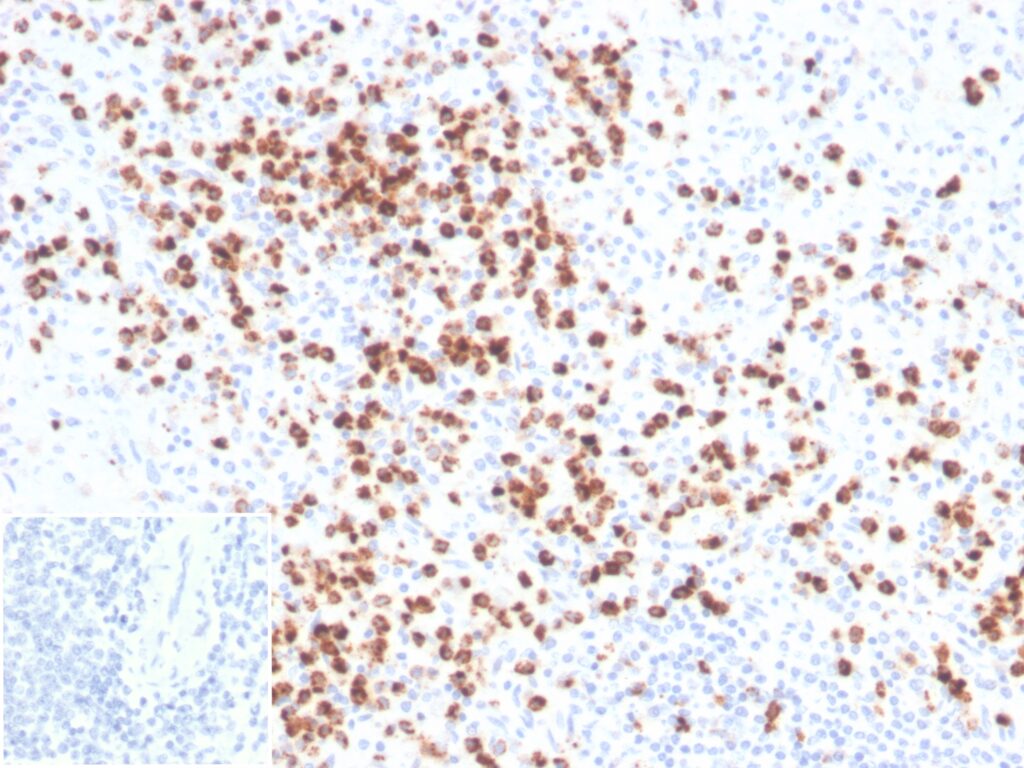 Lysozyme (Histiocytoma &Monocytic Acute Leukemia Marker) Antibody ...