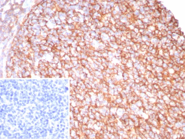 Recombinant CD21 (Mature B-Cell & Follicular Dendritic Cell Marker ...