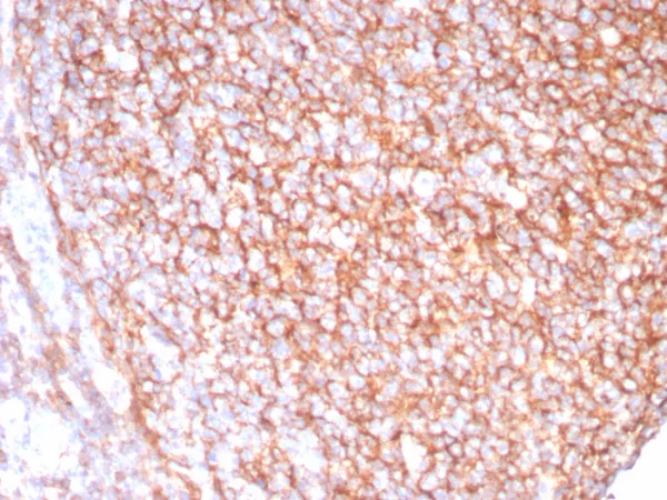 Recombinant CD21 (Mature B-Cell & Follicular Dendritic Cell Marker ...