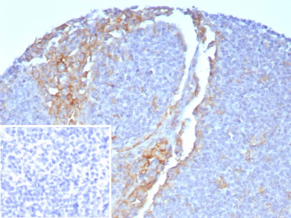 CD64 / Fc gamma RI Antibody - Clone FCGR1A/7496 - Gene ID 2209