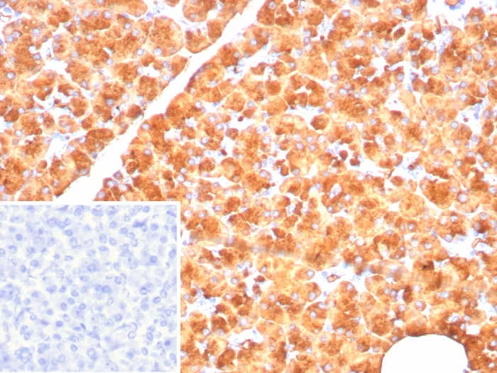Pancreatic lipase / PNLIP Antibody - Clone PNLIP/8916 - Gene ID 5406