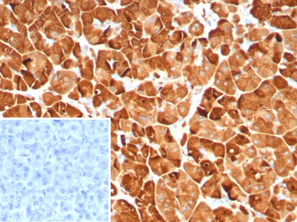 Pancreatic lipase / PNLIP Antibody - Clone PNLIP/9039 - Gene ID 5406