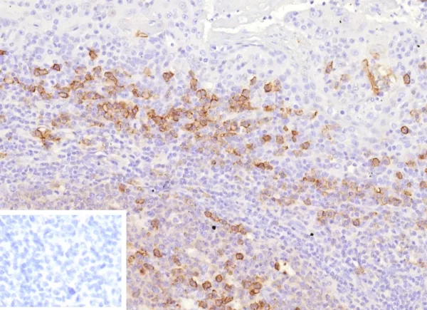 CD38 (ADP Ribosyl Cyclase I) Antibody - Clone CD38/9332 - Gene ID 952