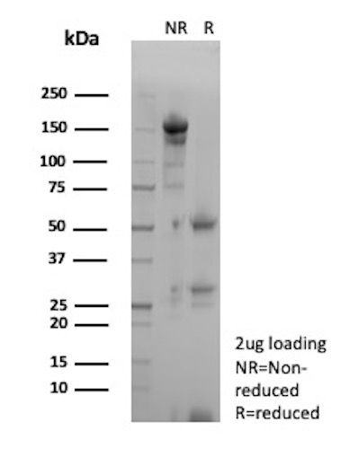 CD11c (Dendritic Cell Marker) Antibody - Clone HC1/1 - Gene ID 3687